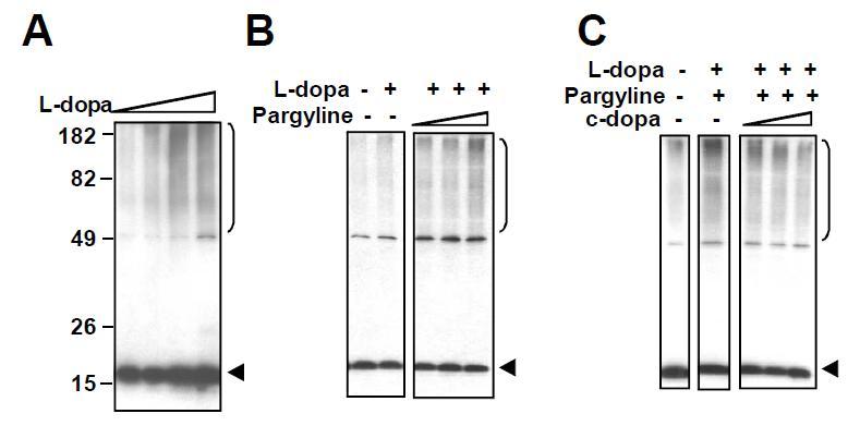 [보고서]유전적, 비유전적 요인들의 연계를 통한 파킨슨병 발병기전 연구