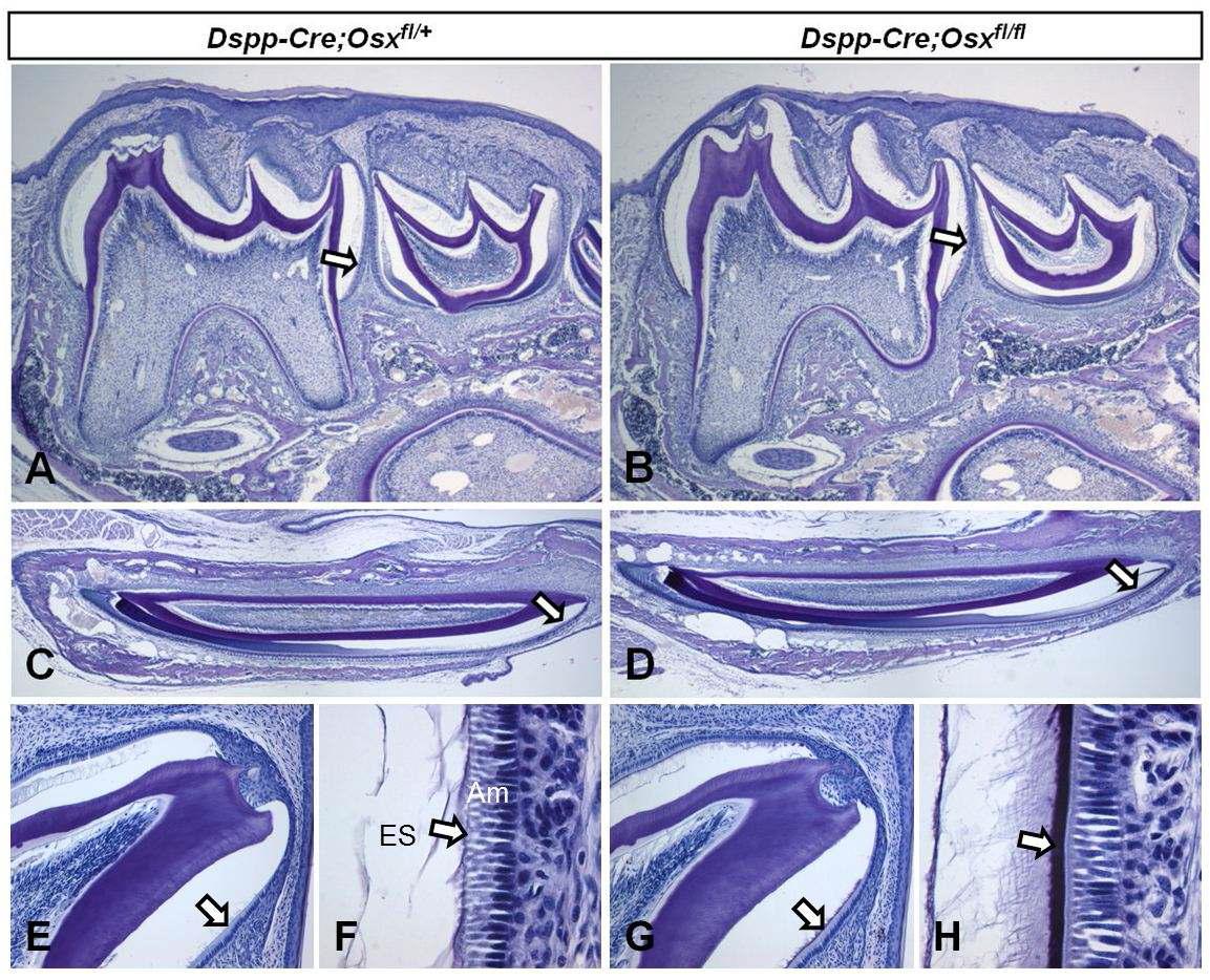 [보고서]시간 및 조직 특이적 조건 유전자적중 생쥐모델에서 Osterix의 전사조절기능 분석을 통한 상아질 형성과 재생유도 기전 연구