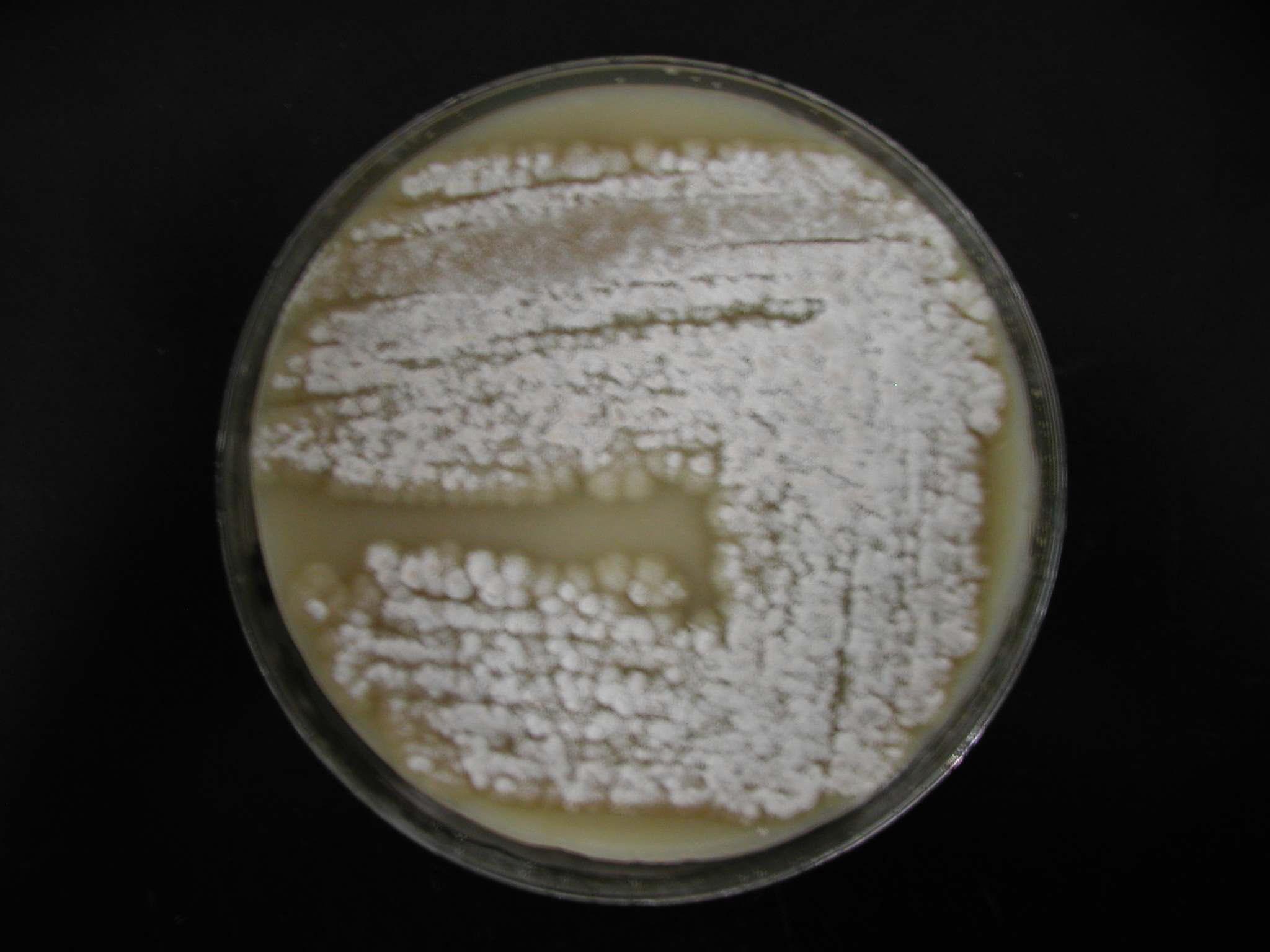 [보고서]국내 자생 토양방선균을 이용한 의료.산업용 혈전용해효소 개발