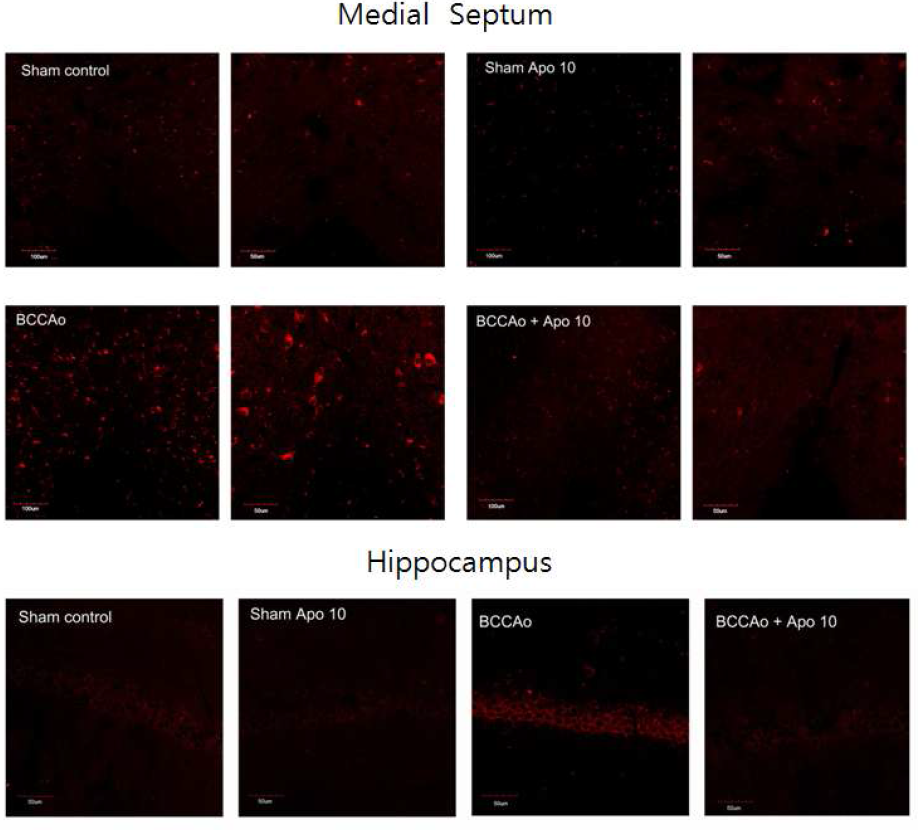 [보고서]만성 혈관성 신경손상에 미치는 새로운 분자기전인 NADPH Oxidase-1 (Nox1) 의 검증
