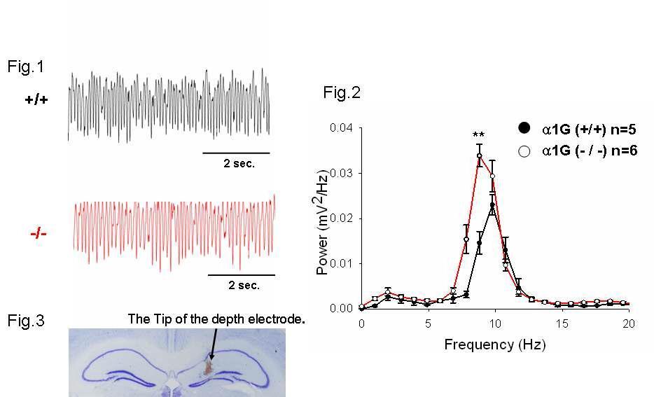 [보고서]유전자 기능 억제 기술을 이용한 분자 세포 및 신경 회로 수준의 뇌 기능 연구