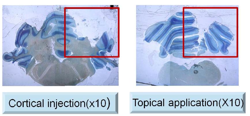 [보고서]소뇌 경색 백서 모델을 이용한 소뇌의 고위 뇌기능 관여 기전 규명
