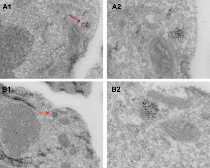 [보고서]N. gruberi의 기저체 형성 소기관-N-GPM complex-의 구조와 기능