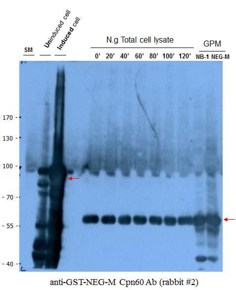 [보고서]N. gruberi의 기저체 형성 소기관-N-GPM complex-의 구조와 기능
