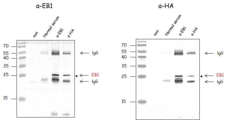 [보고서]Interactome 분석을 통한 람블편모충 세포골격계 조절 단백질 EB1의 기능에 대한 연구