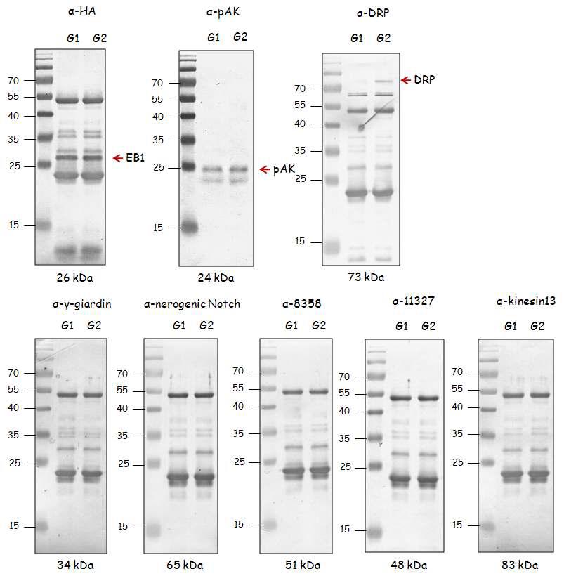 [보고서]Interactome 분석을 통한 람블편모충 세포골격계 조절 단백질 EB1의 기능에 대한 연구