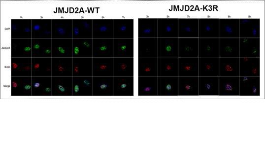[보고서]Post-translational modification에 의한 히스톤 탈메틸화효소인 Jmjd2 가족단백질의 기능 ...