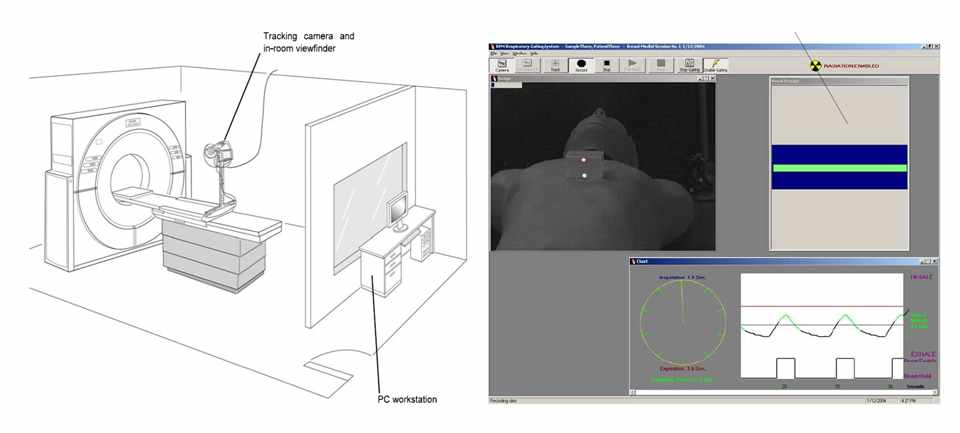 [보고서]방사선치료 시 실시간 자동 환자위치보정 시스템 개발