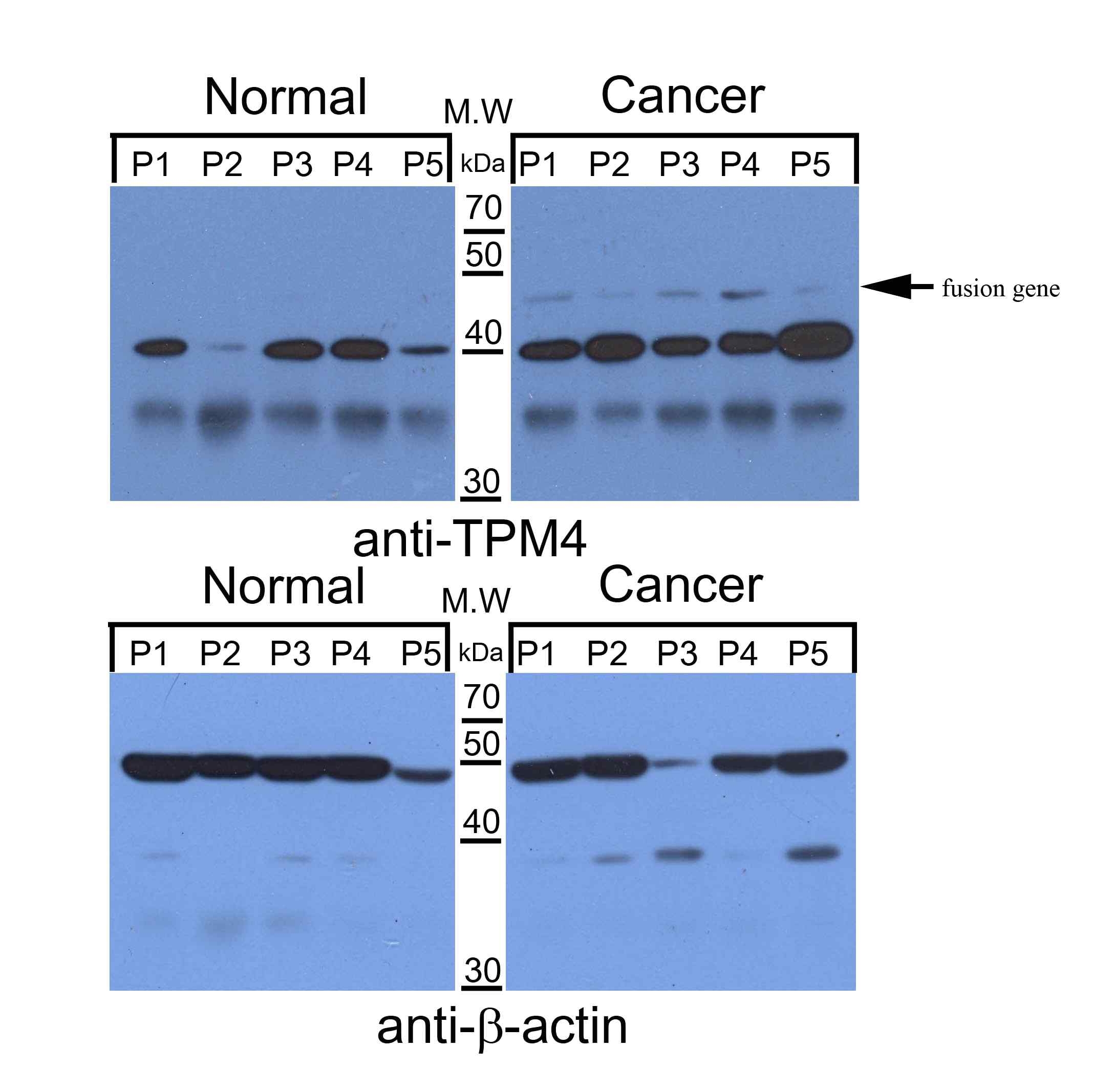 [보고서]분광학 기반 UPR 생체 신호 분석 기술 개발