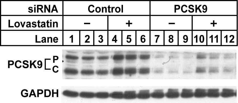 [보고서]PCSK9 발현 억제용 간세포 특이적 지능형 수송체를 이용한 콜레스테롤 대사 조절