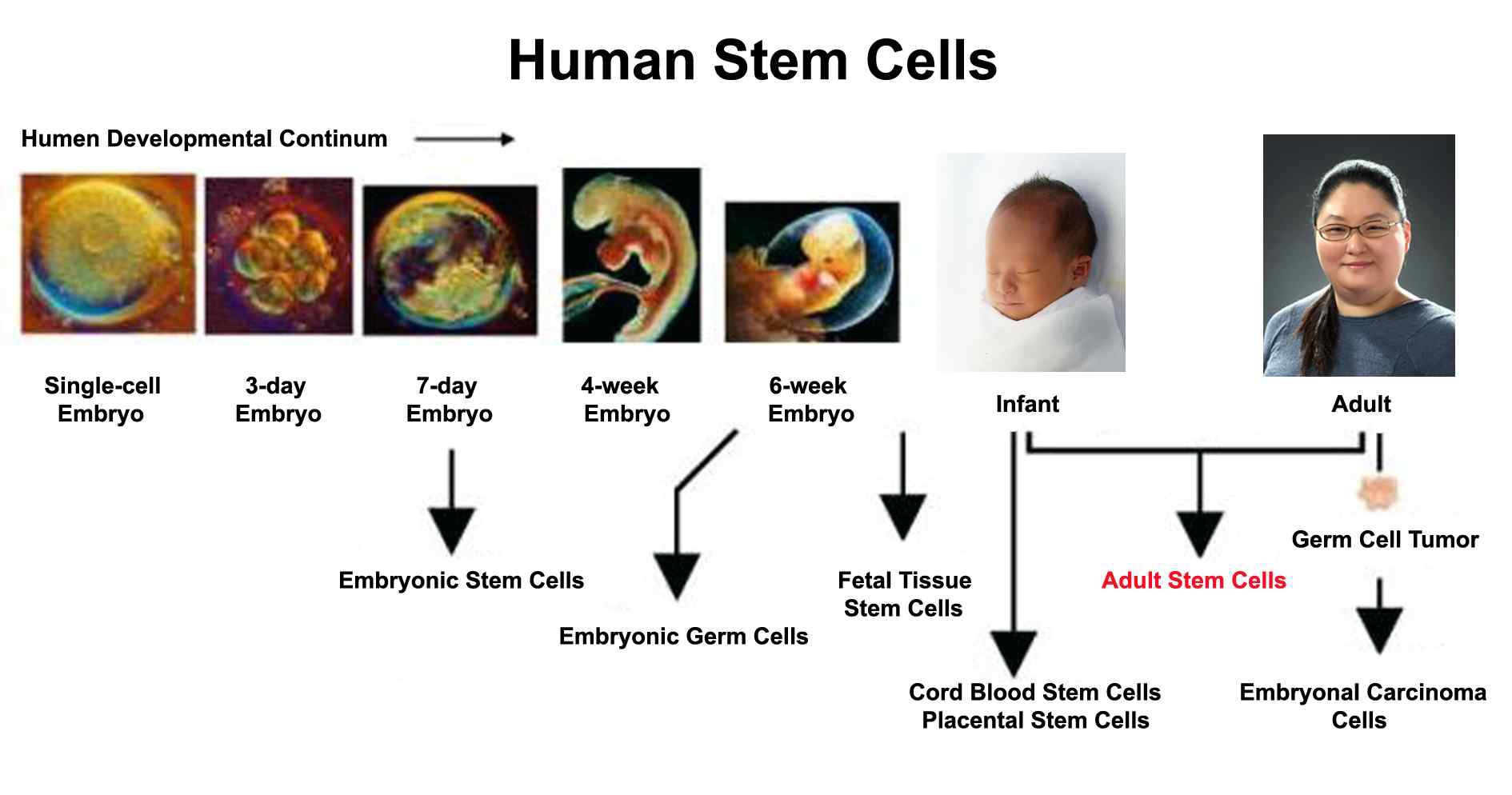 [보고서]치수줄기세포를 이용한 망막신경절세포의 신경보호