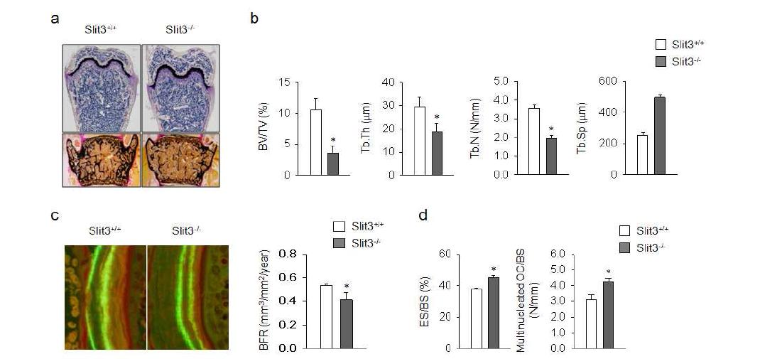 [보고서]짝짓기 인자를 이용한 골다공증의 새로운 바이오마커와 치료 표적 발굴