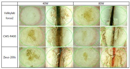 [보고서]인체물성에 따라 주파수와 출력을 자동으로 가변하는 스마트 고주파 수술기