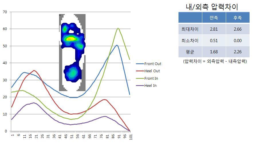 [보고서]발의 운동 안정성 향상을 위한 back count 일체형 arch support 탁구화 개발