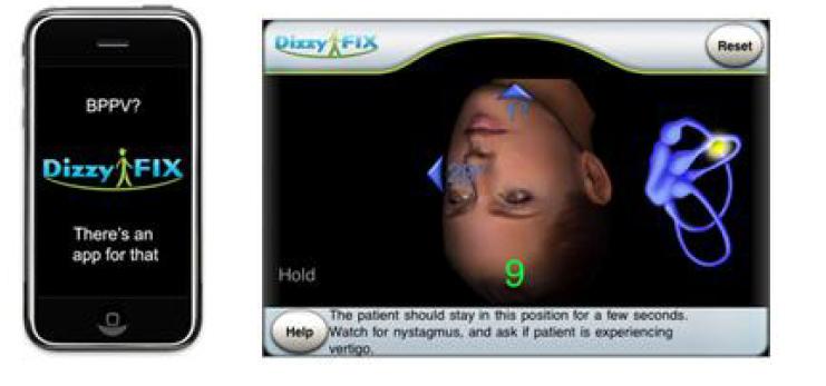[보고서]어지럼증 자가 진단 및 치료 시스템 개발