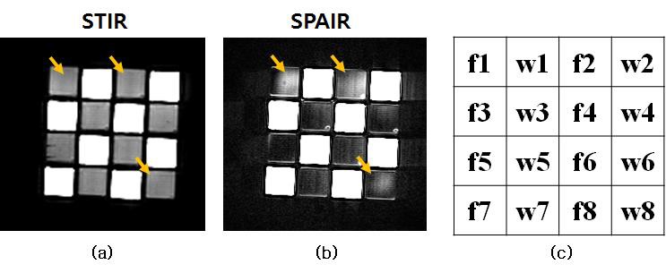 [보고서]의료융합 측정표준 확립