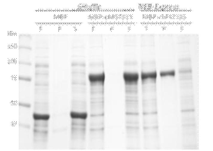 [보고서]자돈의 성장개선을 위한 근육성장 인자의 탐색 및 활성화 기법 연구