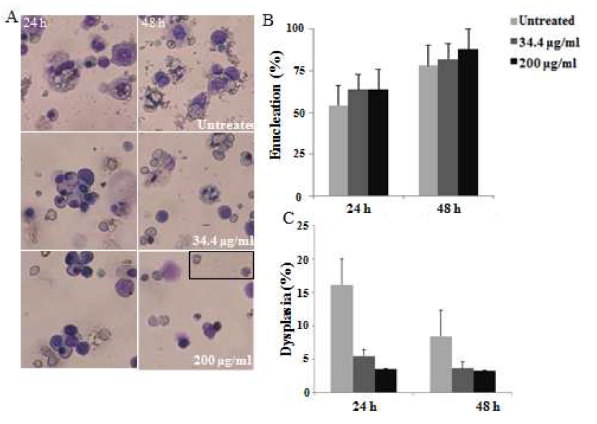 [보고서]줄기세포 분화 및 성숙 유도를 통한 골수형성이상증후군 치료제의 개발