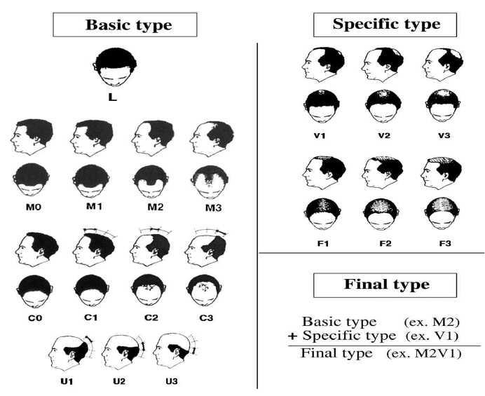 [보고서]줄기세포 배양액 성장인자를 이용한 탈모치료용 조성물 공정개선 및 임상실험