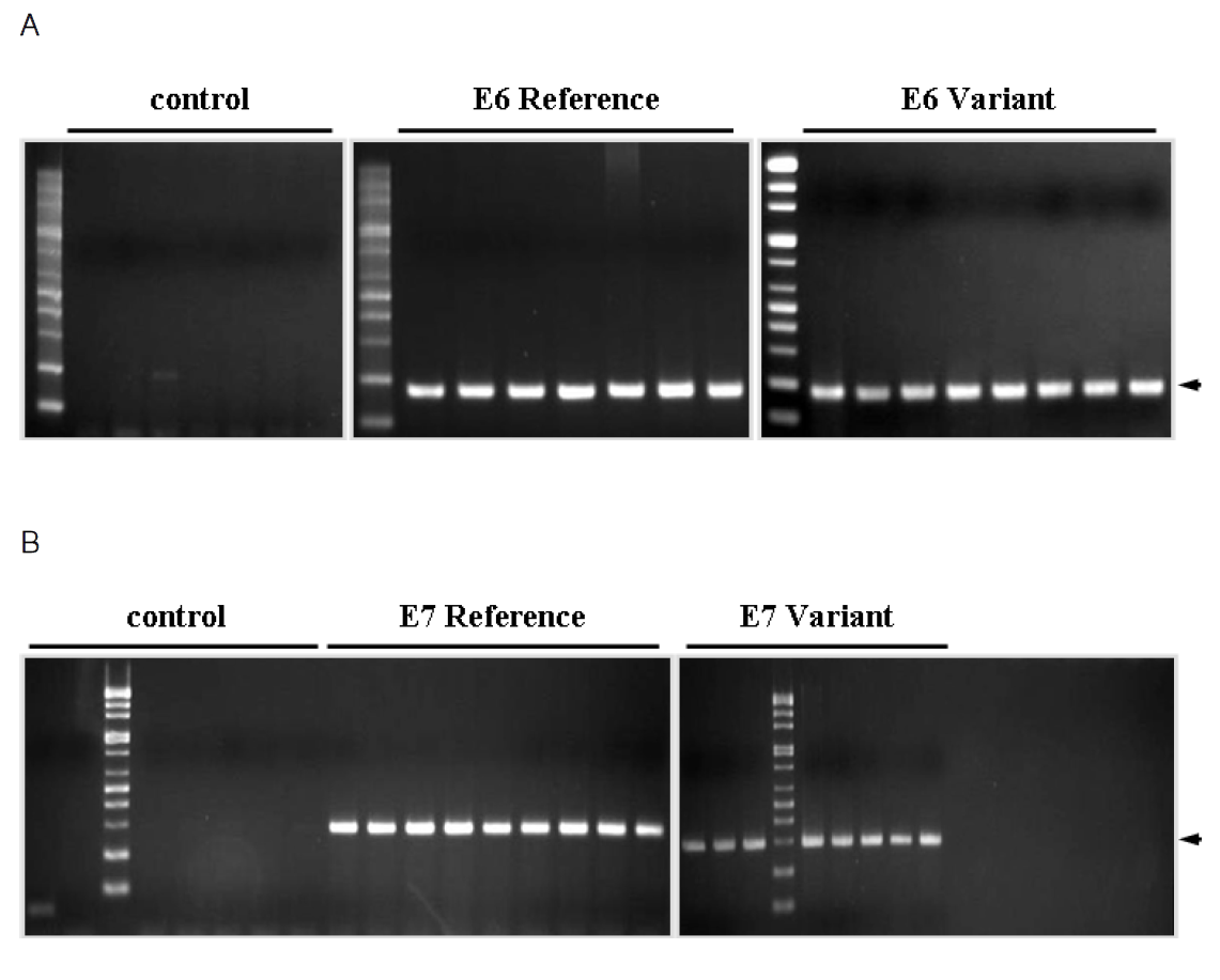 [보고서]국내 HPV 유행주에서 분리된 발암단백질의 자궁경부암화기전 규명