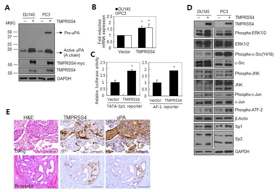 [보고서]MT-SP2 세린프로테아제 저해제 발굴 및 대장암전이 억제기전 연구