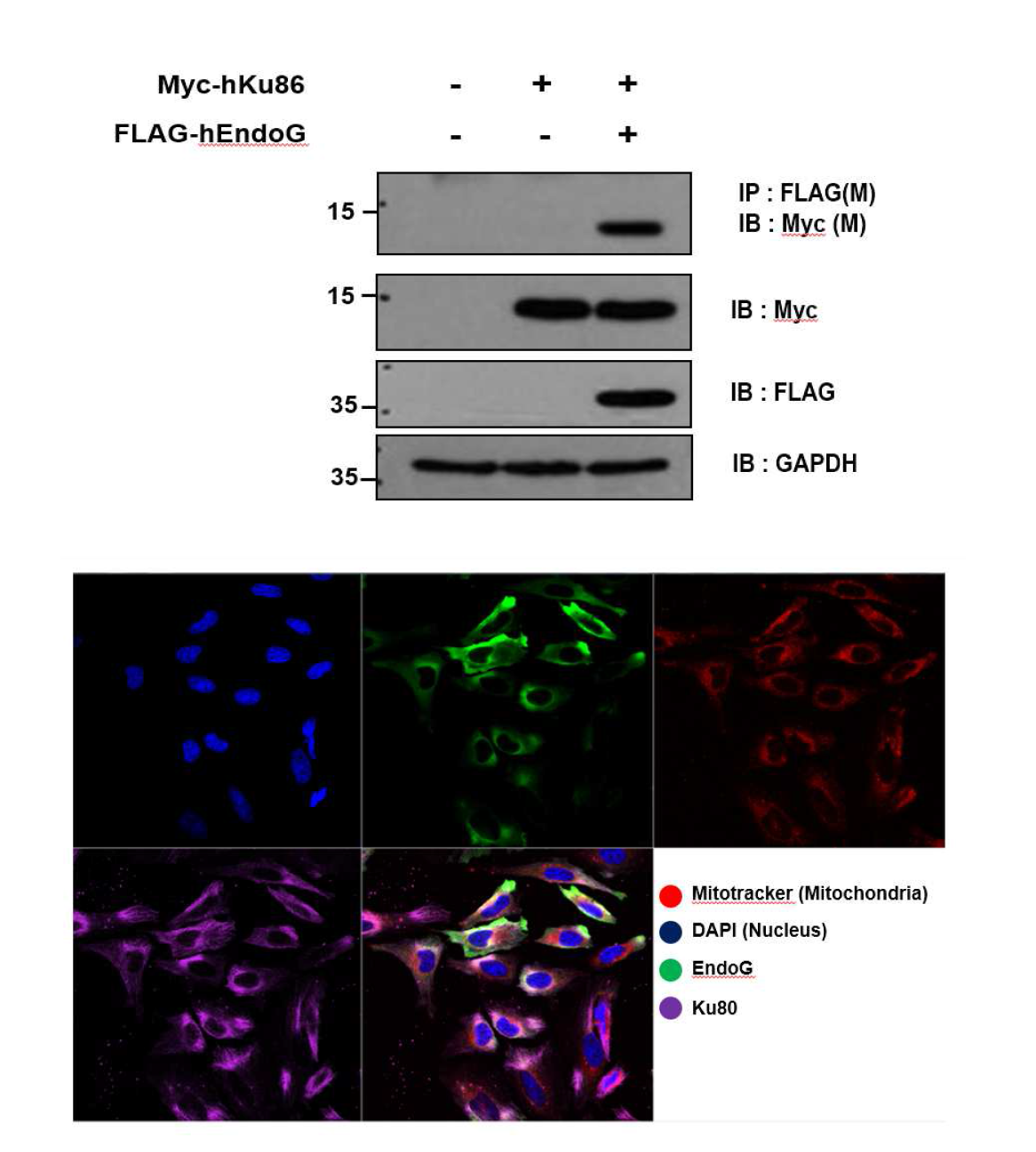 [보고서]심근경색 세포에서의 핵산분해효소 EndoG 기능 연구