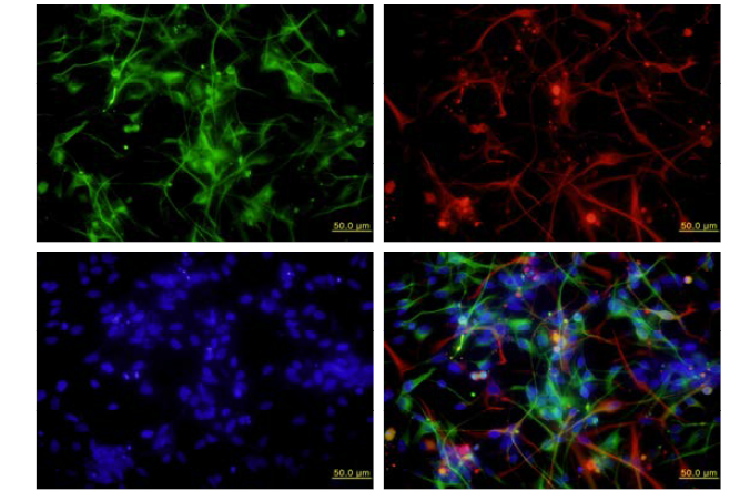 [보고서]복합적 오믹스분석을 이용한 중간엽줄기세포의 신경세포분화효율 증진