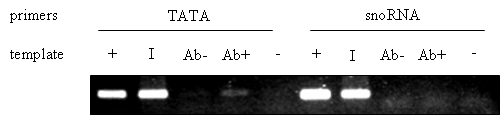 [보고서]DNA repair endonuclease와 관련된 XP 질환 및 발암기작 규명
