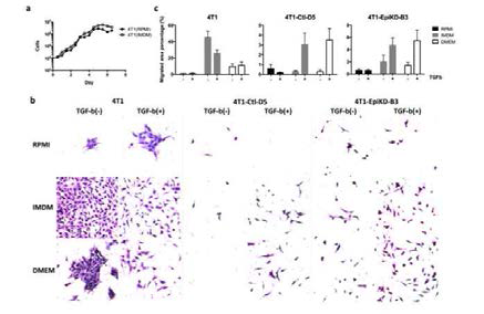 [보고서]암전이 신호전달체계 수립을 위한 PRSS14의 발현과 기능 네트워크 연구