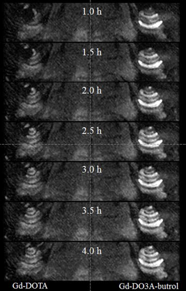 [보고서]난치성 난청 치료용 이중 약물 복합 주사제형 전달체의 유효성/안전성 검증