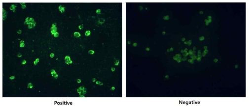 [보고서]신증후군출혈열 진단제제 생산