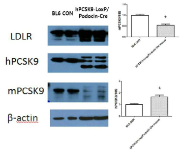 [보고서]족세포내 지질 대사 이상의 기전 규명 및 치료 약물 탐색