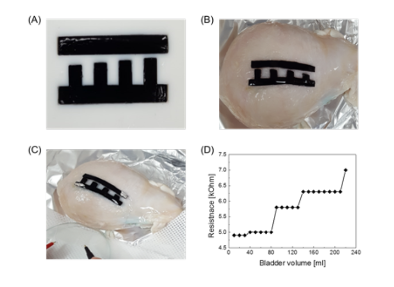 [보고서]요실금 환자를 위한 인공요도괄약근에 집적될 체내삽입용방광볼륨센서 개발