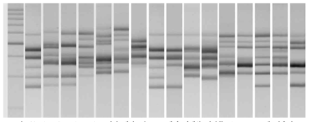[보고서]분자유전학적 기법을 이용한 Clostridium difficile 감염의 역학적 특성 분석 및 임상경과 예측
