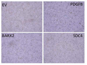 [보고서]근육의 차등발현유전자 기능 구명을 통한 가금 생산성 향상 연구