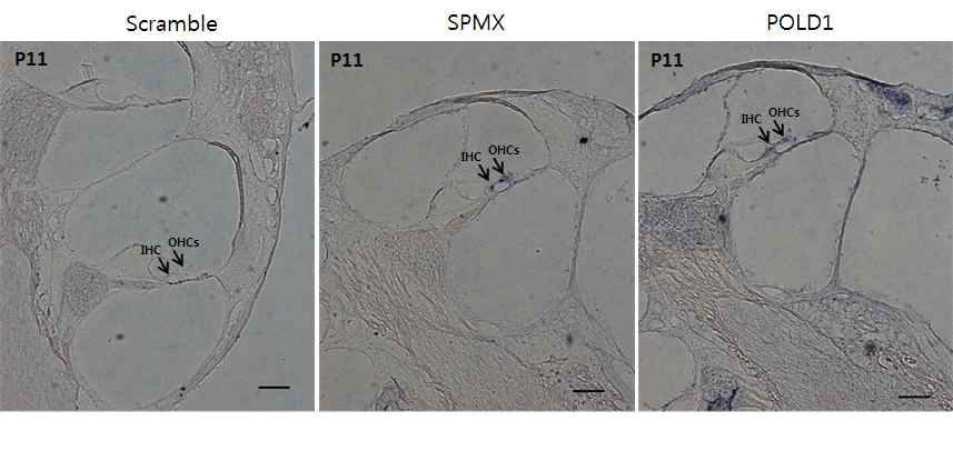 [보고서]난청과 암을 포함하는 표현형 다면발현을 보이는 POLD1 유전자의 발병 기전 규명 및 이를 이용한 진단 및 치료계획에의 적용