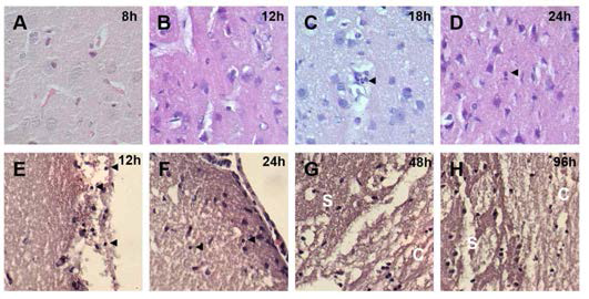 [보고서]뇌졸중 후 급성염증반응에서 DAMPs에 의한 NETosis 조절 기전 연구