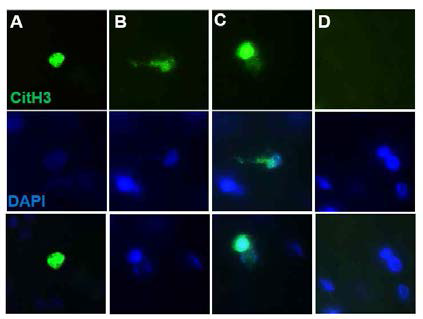 [보고서]뇌졸중 후 급성염증반응에서 DAMPs에 의한 NETosis 조절 기전 연구