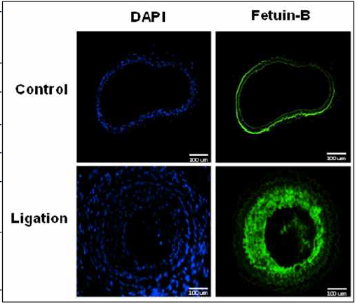 [보고서]새로운 단백질 Fetuin-B의 불안정성 동맥경화반 생성기전 연구