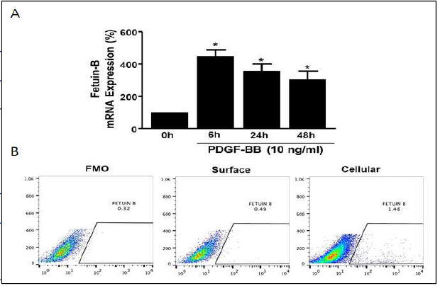 [보고서]새로운 단백질 Fetuin-B의 불안정성 동맥경화반 생성기전 연구