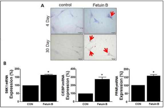 [보고서]새로운 단백질 Fetuin-B의 불안정성 동맥경화반 생성기전 연구