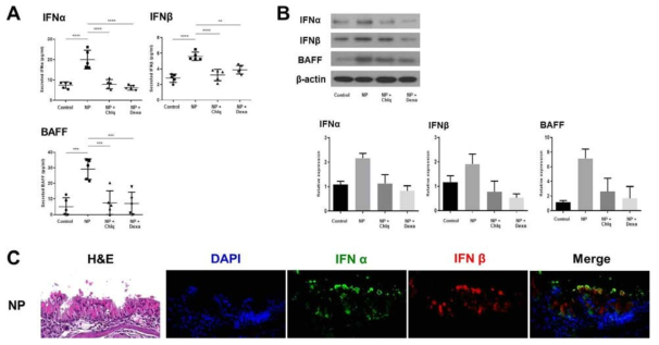 [보고서]TLR 7/9에 의해 유도된 BAFF의 발현이 비용을 동반한 만성비부비동염의 병태생리에 미치는 영향에서 관한 연구
