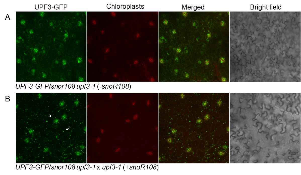 [보고서]snoR108의 전사후 유전자발현 조절과 저항성 네트워크