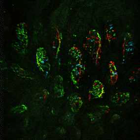 [보고서]다양한 암종과 암의 전이단계에 대한 in vivo imaging 기법 확립