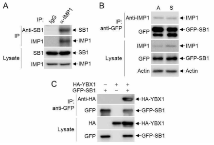 [보고서]IMP1 RNA granule에 의한 RNA 운명 조절이 DNA 손상 회복 및 발암과정에 미치는 영향 연구