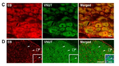 [보고서]신경병증성통증에 대한 Evans blue의 진통효과, 작용기전 및 응용연구