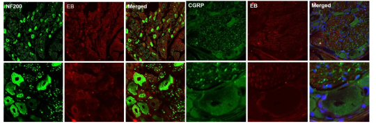 [보고서]신경병증성통증에 대한 Evans blue의 진통효과, 작용기전 및 응용연구