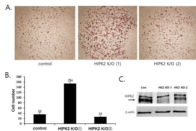 [보고서]HIPK2에 의한 전사인자 KLF5의 단백질 안정화 기전 규명 및 세포내 기능 탐색