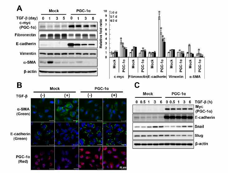 [보고서]신장 보호 효과의 네트워크 중심축으로서의 PGC-1 alpha의 역할에 관한 연구