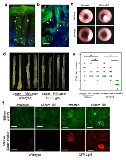 [보고서]치료 단계에 따른 종양줄기세포의 유전자변이 추적과 이를 이용한 항종양치료제의 효용성 탐색 연구